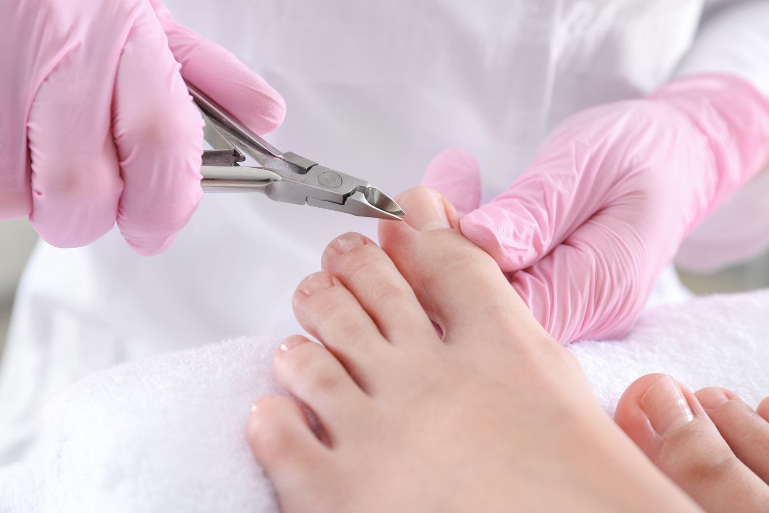 Extracción de Uñeros en Surco - EF Salón